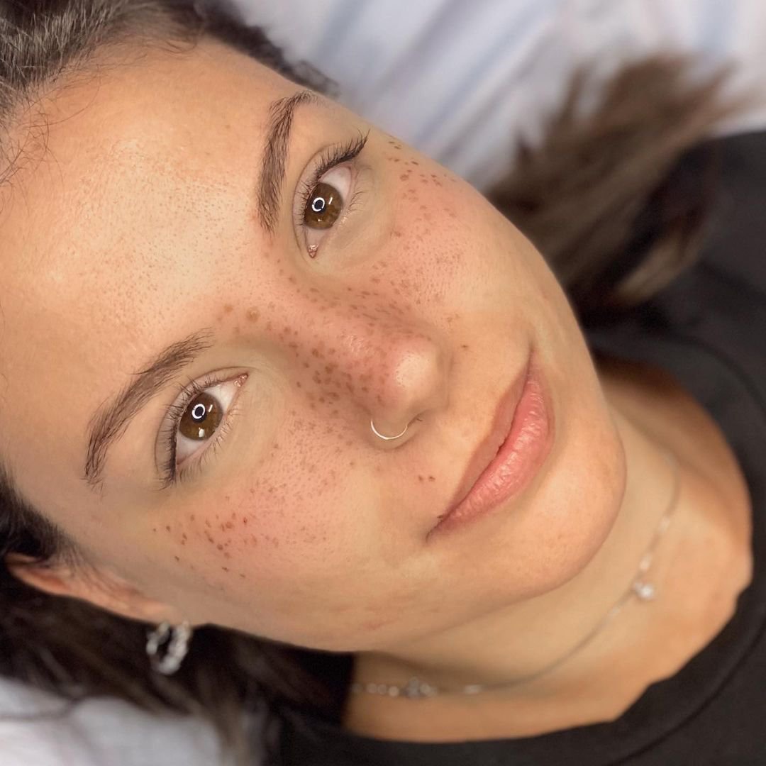 Freckle Tattoos | 10 Masters